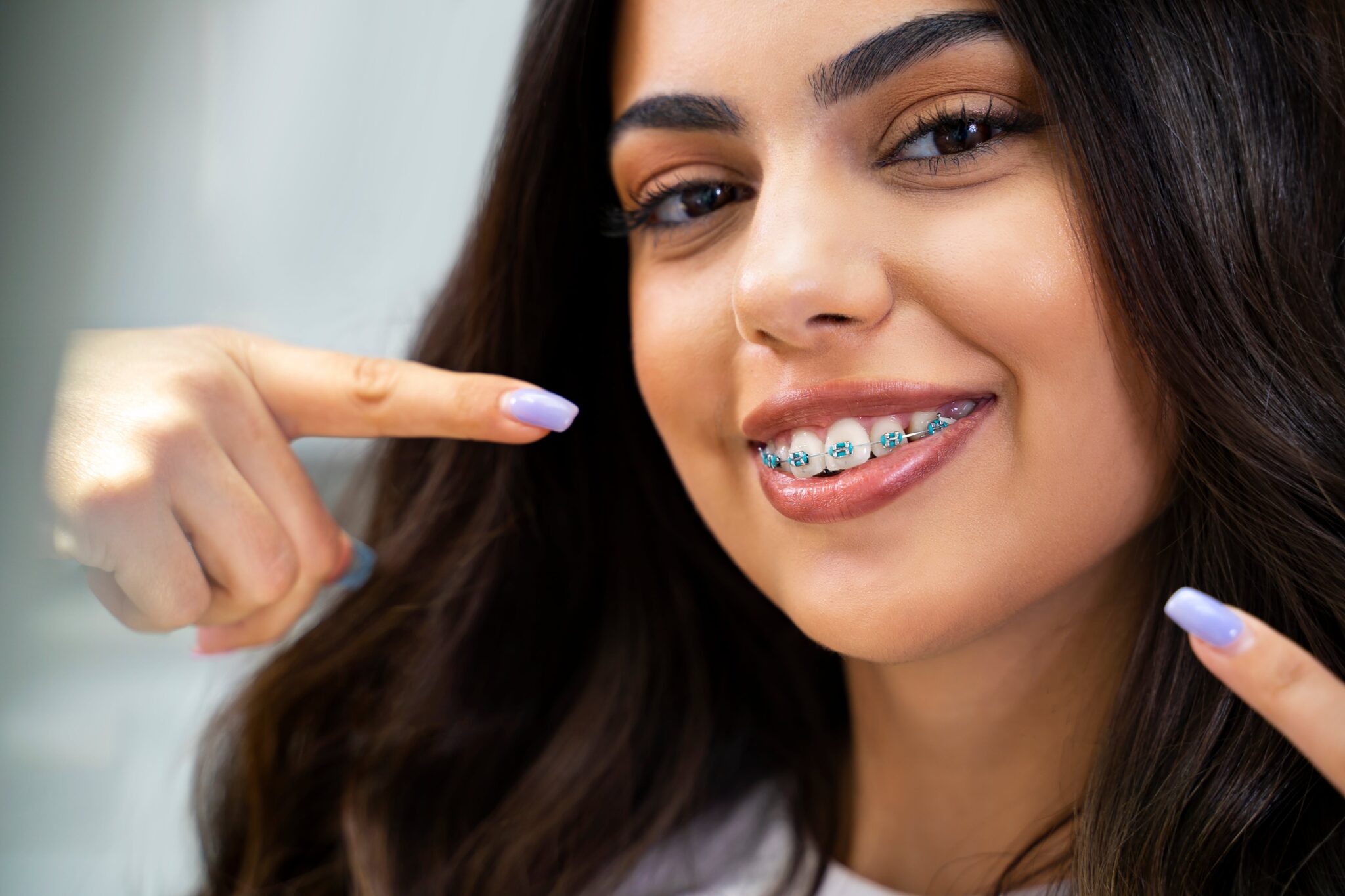 Why More Adults Are Choosing Braces Than Ever Before - Belle Orthodontics